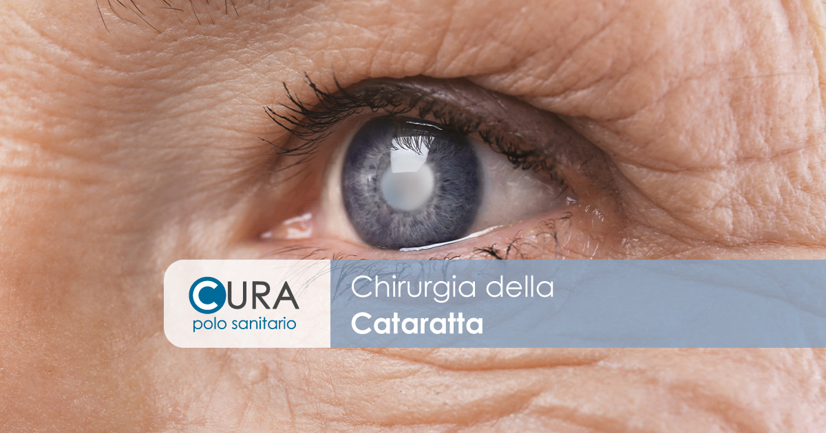 Chirurgia della Cataratta: Chirurgia ambulatoriale - Cura Polo ...